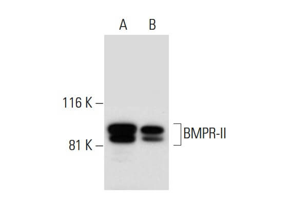 Anti-BMPR-II Antibody (E-1) | SCBT - Santa Cruz Biotechnology