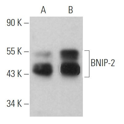 Anti-BNIP-2 Antibody (A-6) | SCBT - Santa Cruz Biotechnology