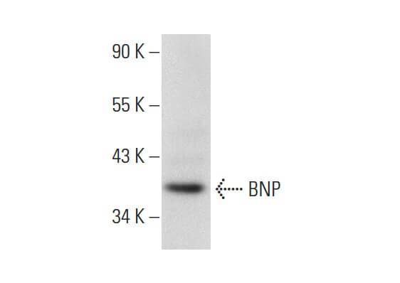 BNP Antibody (D-8) | SCBT - Santa Cruz Biotechnology