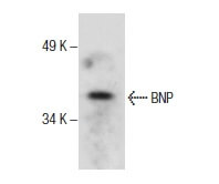 Anti-BNP Antibody (D-8) | SCBT - Santa Cruz Biotechnology
