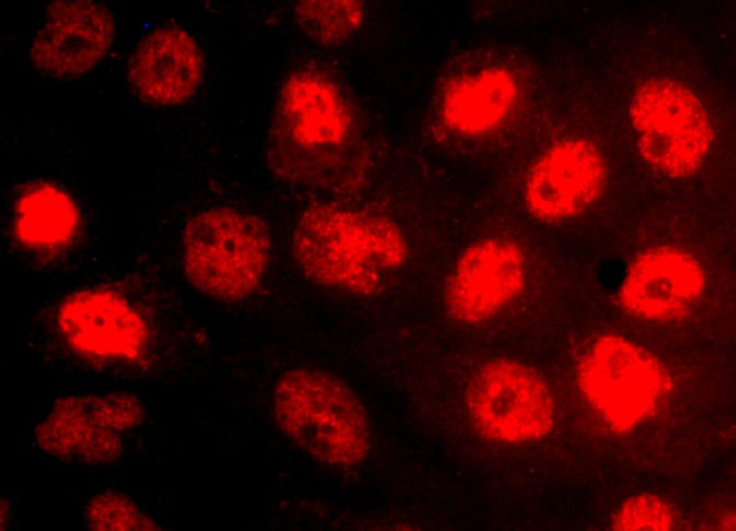 bovine anti-goat IgG-R Secondary Antibody | SCBT - Santa Cruz Biotechnology
