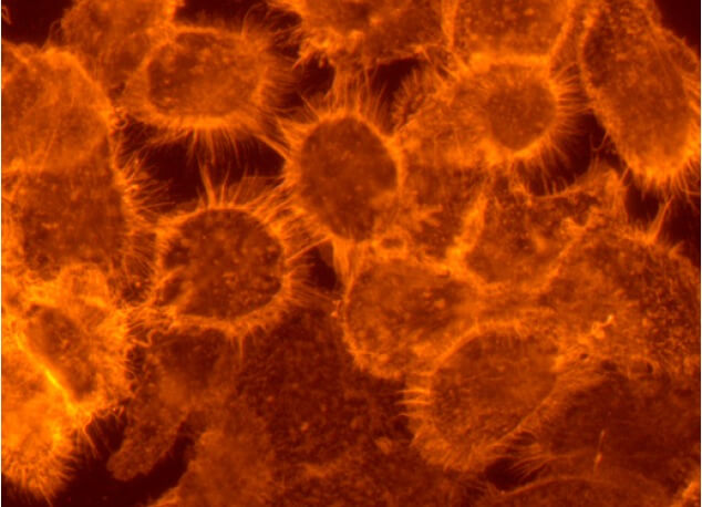 bovine anti-rabbit IgG-CFL 555 Secondary Antibody | SCBT - Santa Cruz ...