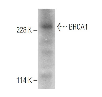 Anti-BRCA1 Antibody (D-9) | SCBT - Santa Cruz Biotechnology