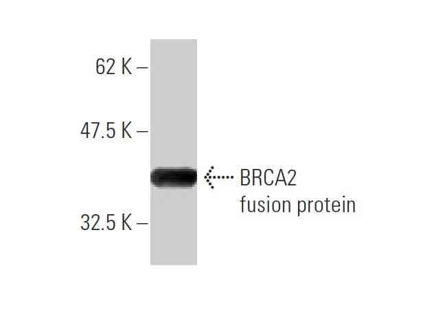 BRCA2 Antibody (3D12) | SCBT - Santa Cruz Biotechnology
