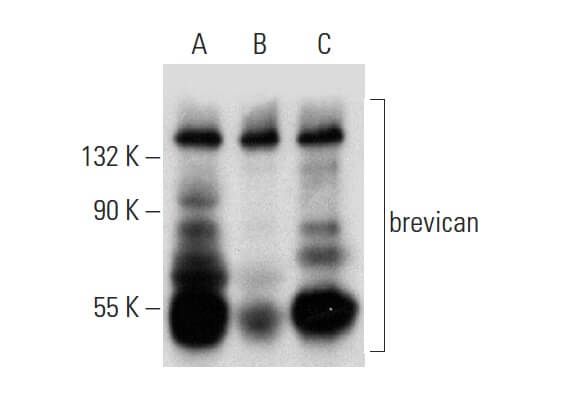 brevican Antibody (2) | SCBT - Santa Cruz Biotechnology