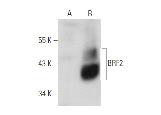 Anti-BRF2 Antibody (A-12) | SCBT - Santa Cruz Biotechnology