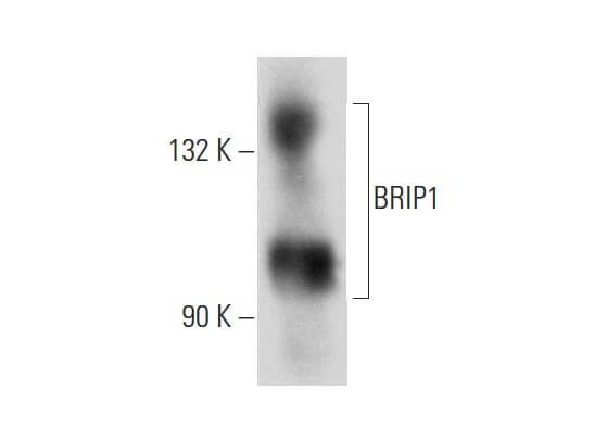 BRIP1 Antibody (E-11) | SCBT - Santa Cruz Biotechnology