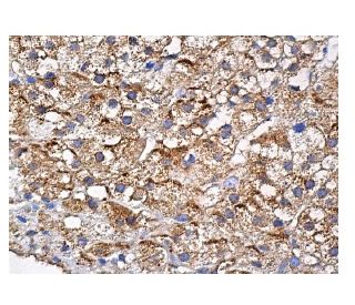 BSEP Antibody (F-6) - Immunohistochemistry - Image 157196