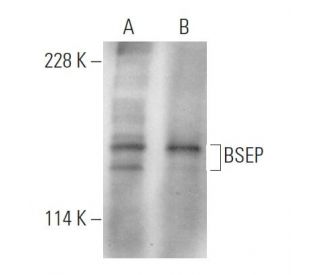 BSEP Antibody (F-6) - Western Blotting - Image 364940