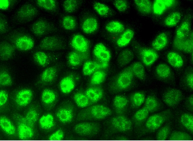 Anti-BTEB2 Antibody (G-7) | SCBT - Santa Cruz Biotechnology