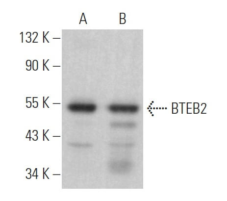 Anti-BTEB2 Antibody (G-7) | SCBT - Santa Cruz Biotechnology