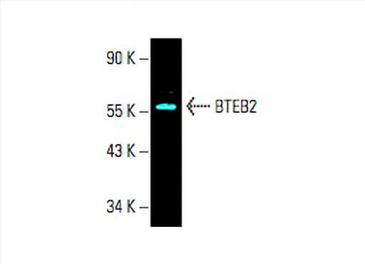 Anti-BTEB2 Antibody (G-7) | SCBT - Santa Cruz Biotechnology