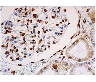 C23 (Nucleolin) Antibody (MS-3) | SCBT - Santa Cruz Biotechnology