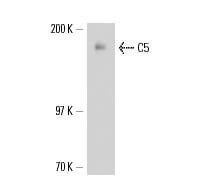 C5 Antibody (6A532) | SCBT - Santa Cruz Biotechnology
