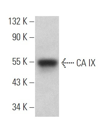 Anti-CA IX Antibody (H-11) | SCBT - Santa Cruz Biotechnology