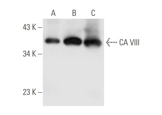 CA VIII Antibody (E-4) | SCBT - Santa Cruz Biotechnology
