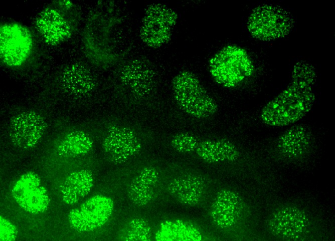Anti-CAF-1 p150 Antibody (D-1) | SCBT - Santa Cruz Biotechnology