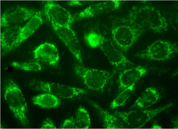 Anti-Calnexin Antibody (AF18) | SCBT - Santa Cruz Biotechnology