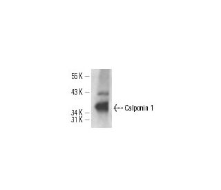 Calponin 1 Antibody (CALP) - Western Blotting - Image 14274