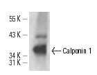 Anti-Calponin 1 Antibody (CALP) | SCBT - Santa Cruz Biotechnology