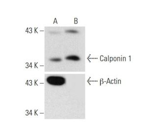 Anti-Calponin 1 Antibody (CALP) | SCBT - Santa Cruz Biotechnology