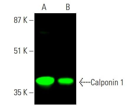Calponin 1 Antibody (CALP) | SCBT - Santa Cruz Biotechnology