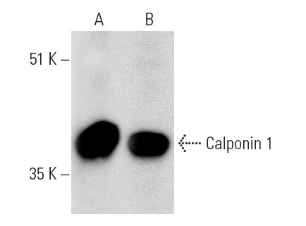 Anti-Calponin 1 Antibody (CALP) | SCBT - Santa Cruz Biotechnology