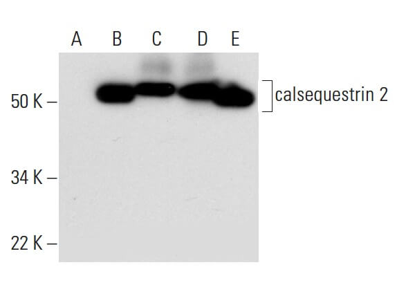 Anti-calsequestrin 2 Antibody (E-12) | SCBT - Santa Cruz Biotechnology