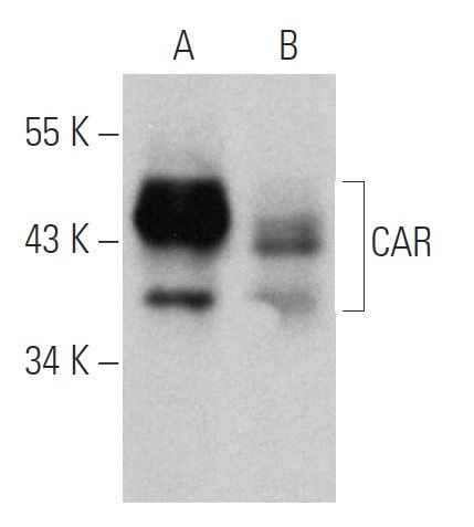 CAR Antibody (Mab.E[mh] 1) | SCBT - Santa Cruz Biotechnology