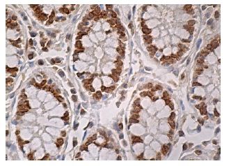 CARMIL Antibody (E-10) | SCBT - Santa Cruz Biotechnology