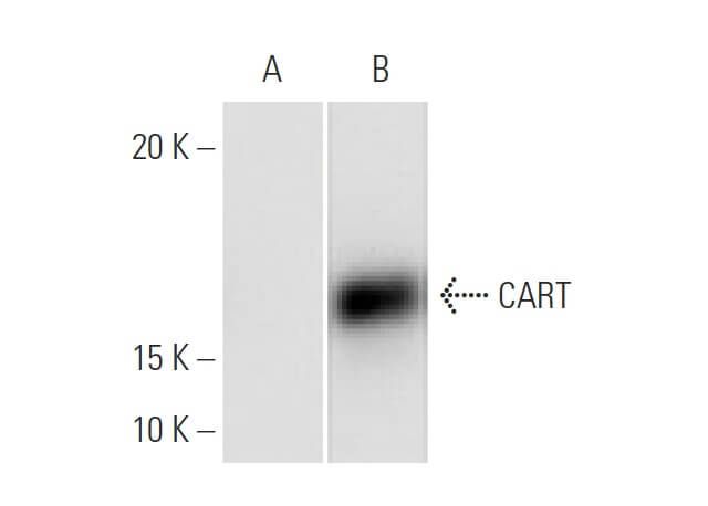 CART Antibody (3E4) | SCBT - Santa Cruz Biotechnology