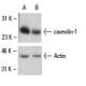 caveolin-1 siRNA (h), shRNA and Lentiviral Particle Gene Silencers ...