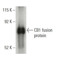 Anti-CB1/Cannabinoid Receptor 1/CNR1 Antibody (C-11) | SCBT - Santa ...