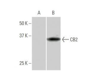 CB2 Antibody (3C7) | SCBT - Santa Cruz Biotechnology