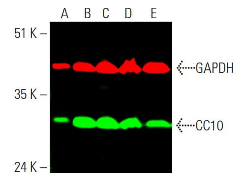 Anti-Uteroglobin/SCGB1A1/CC10 Antibody (E-11) | SCBT - Santa Cruz ...