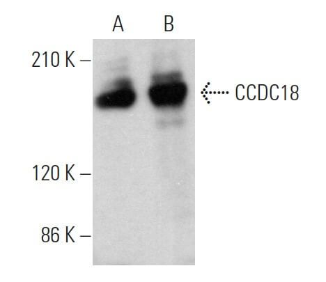 CCDC18抗体 (G-5) | SCBT - Santa Cruz Biotechnology