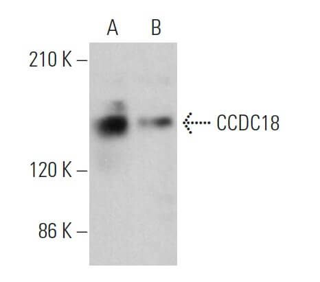 CCDC18 Antibody (H-2) | SCBT - Santa Cruz Biotechnology