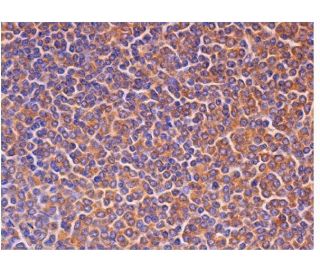 CD10 Antibody (F-4) - Immunohistochemistry - Image 284784