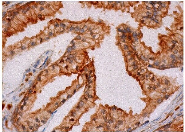 Anti-CD177 Antibody (C-5) | SCBT - Santa Cruz Biotechnology