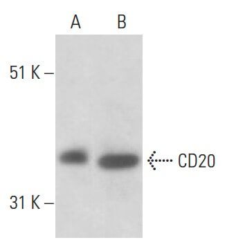 CD20抗体 (BC-1) | SCBT - Santa Cruz Biotechnology