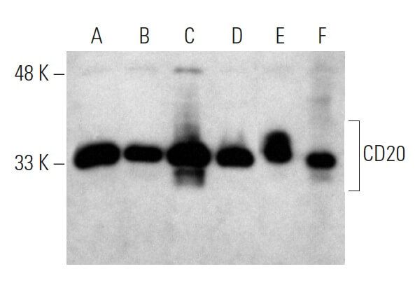 CD20抗体 (D-10) | SCBT - Santa Cruz Biotechnology