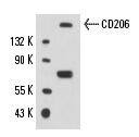 CD206/Mannose Receptor/MMR抗体 (15-2) | SCBT - Santa Cruz Biotechnology