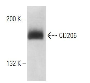 CD206/Mannose Receptor/MMR抗体 (6A598) | SCBT - Santa Cruz Biotechnology