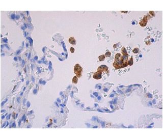 CD206 Antibody (D-1) - Immunohistochemistry - Image 354189