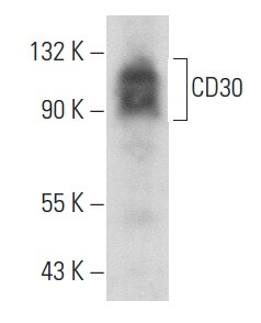 Anti-CD30 Antibody (B-10) | SCBT - Santa Cruz Biotechnology