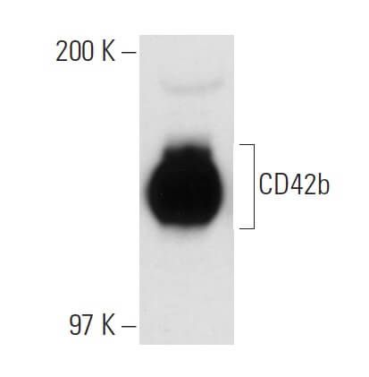 CD42b抗体 (SZ2) | SCBT - Santa Cruz Biotechnology