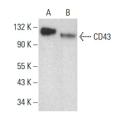 CD43 Antibody (84-3C1) | SCBT - Santa Cruz Biotechnology