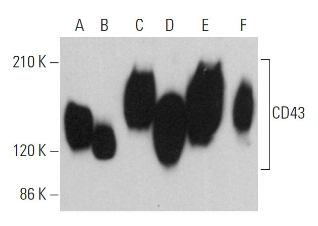 Anti-CD43 Antibody (DF-T1) | SCBT - Santa Cruz Biotechnology