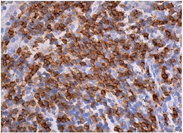 CD45RO Antibody (UCH-L1) | SCBT - Santa Cruz Biotechnology