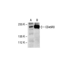 CD45RO Antibody (UCH-L1) - Western Blotting - Image 4856